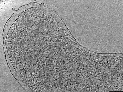 Electron cryotomography (ECT)